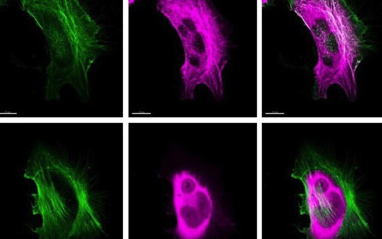 Lifting cancer's invisibility cloak: Dying tumor cells alert the immune ...