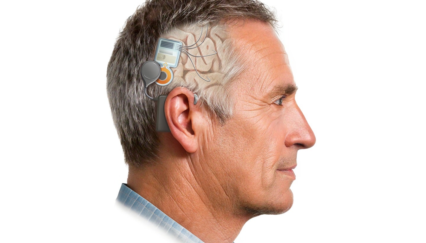 Nia Therapeutics publishes first in vivo validation of SNS