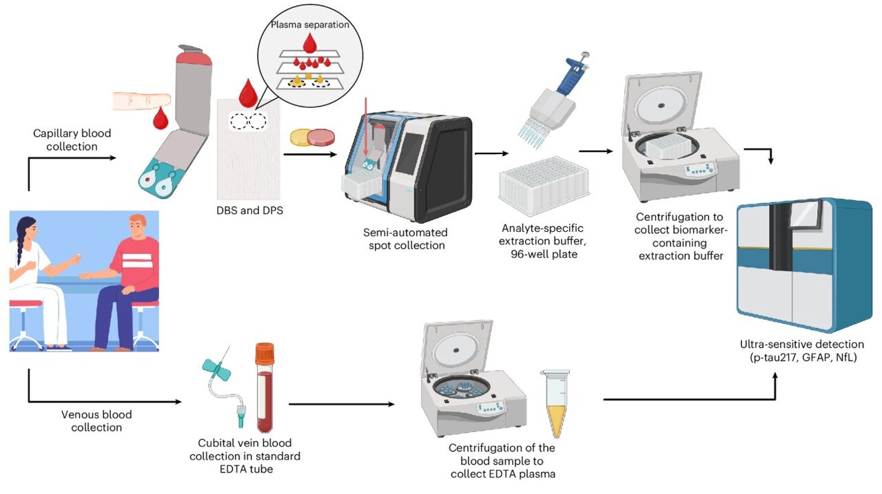 Remote Alzheimer's testing: At-home blood tests can accurately detect ...