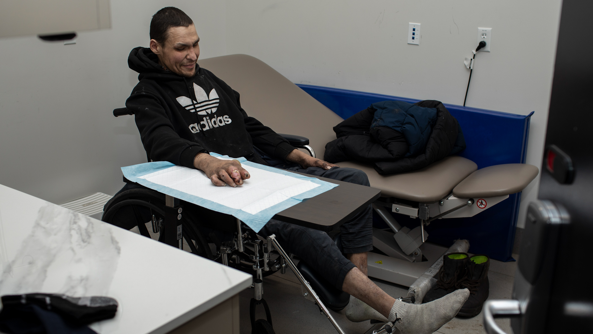 Efforts to reduce frostbite amputations underway in Edmonton
