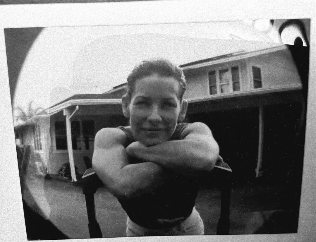 Evangeline Lilly, rivelazione shock dopo l’incidente: "Danni al cervello"