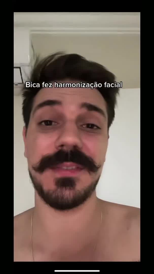 Bica fez harmonização facial