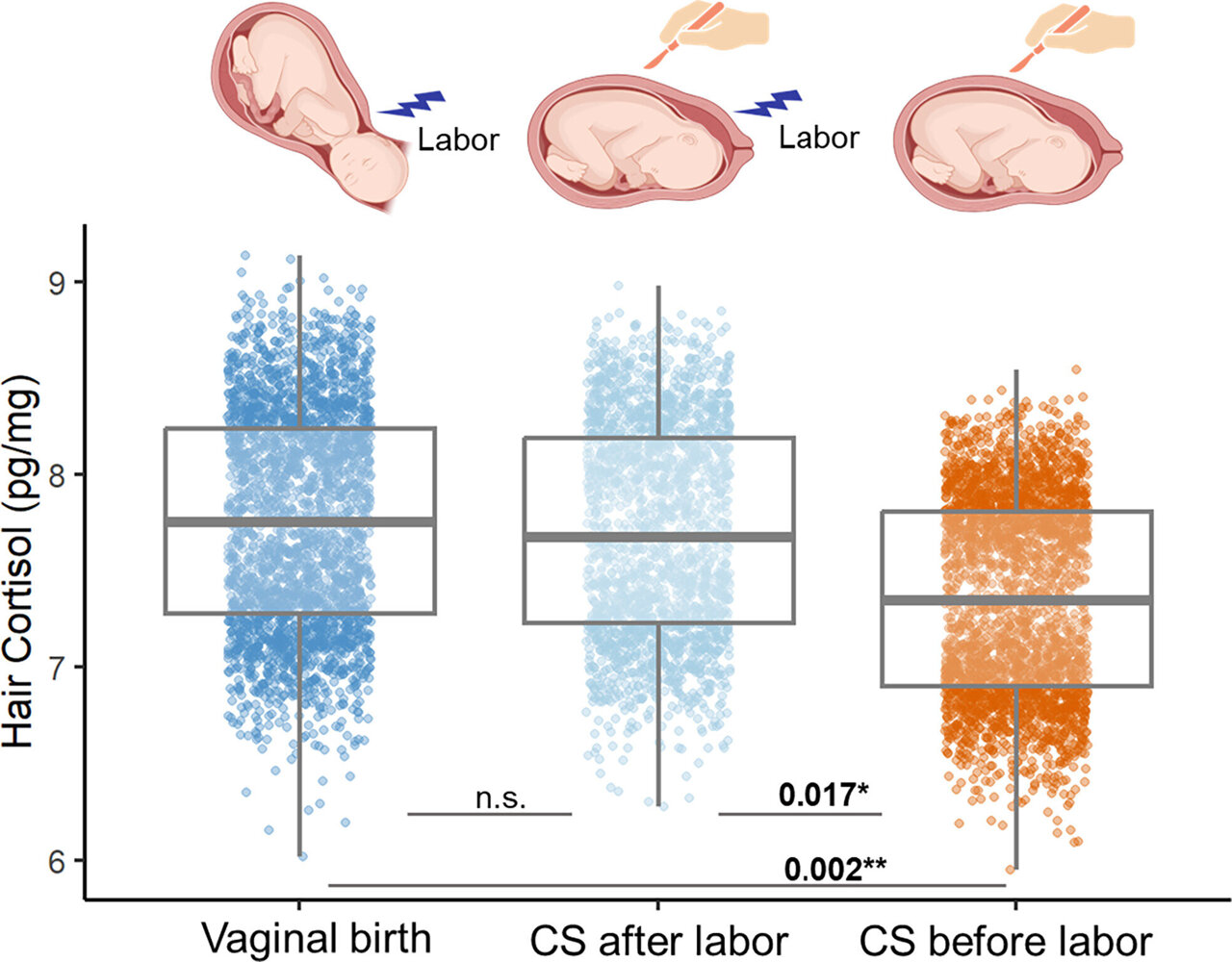 Elective C-sections linked to lower childhood cortisol