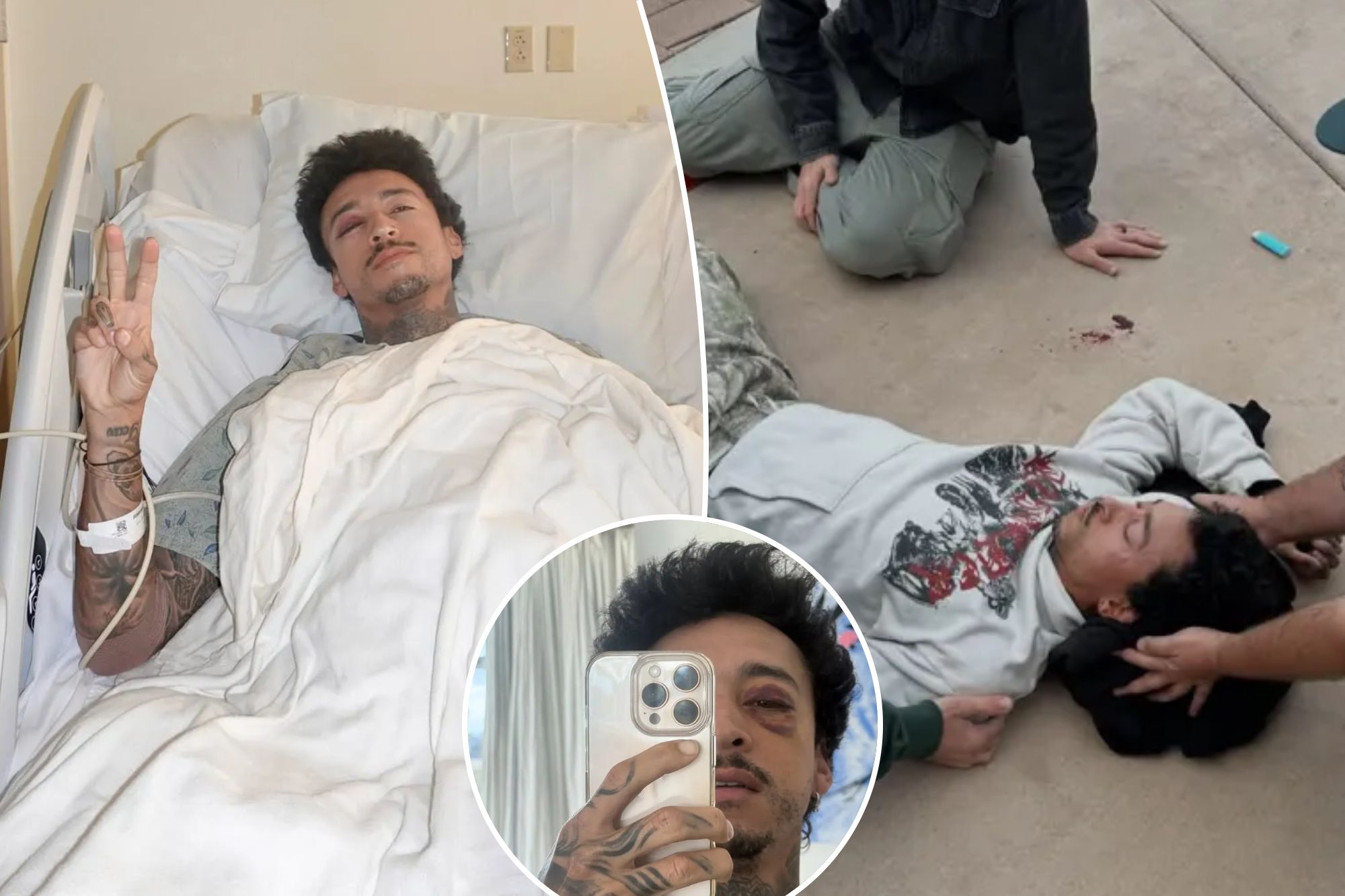 Olympic bronze medalist Nyjah Huston suffers fractured skull, eye ...