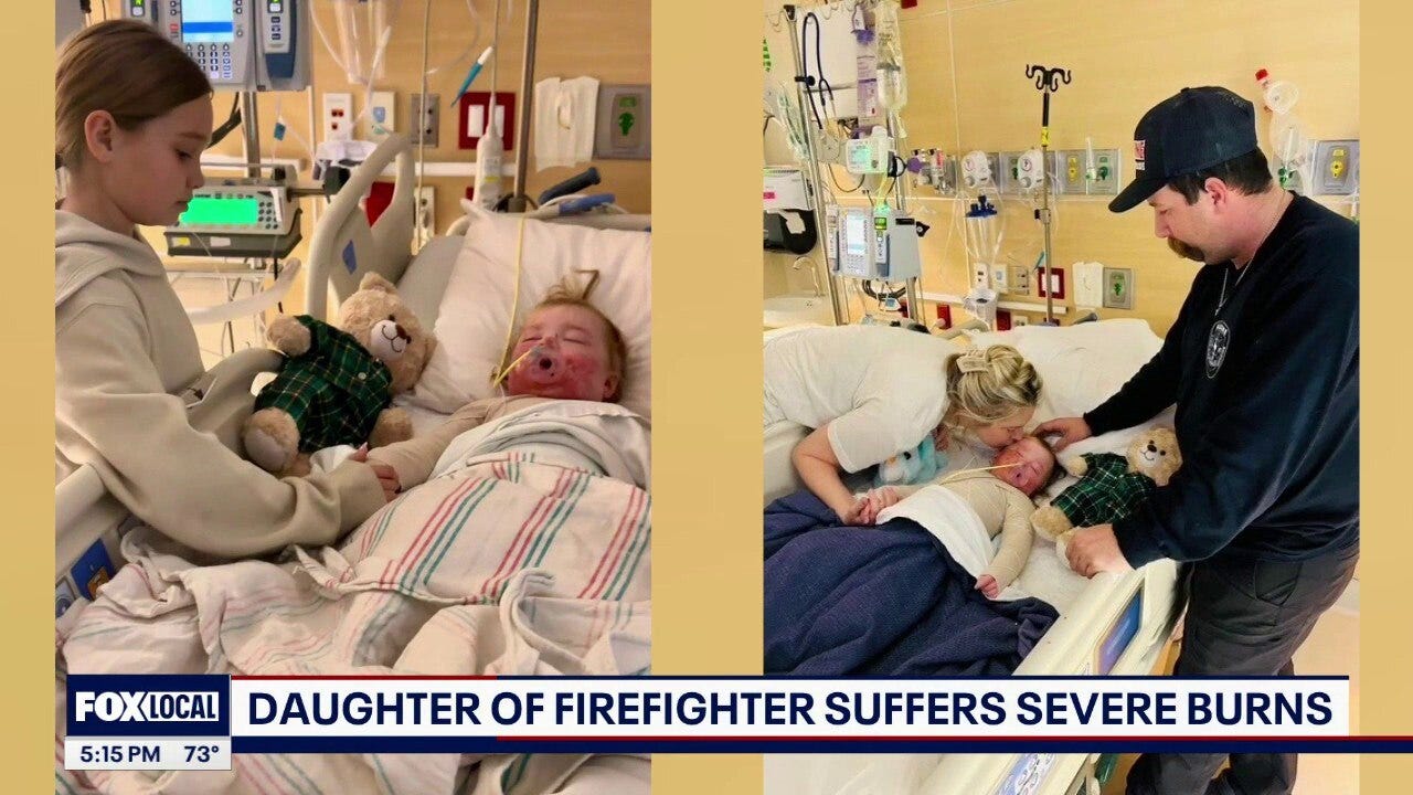 Firefighter’s 1-year-old daughter recovering after severe burns ...