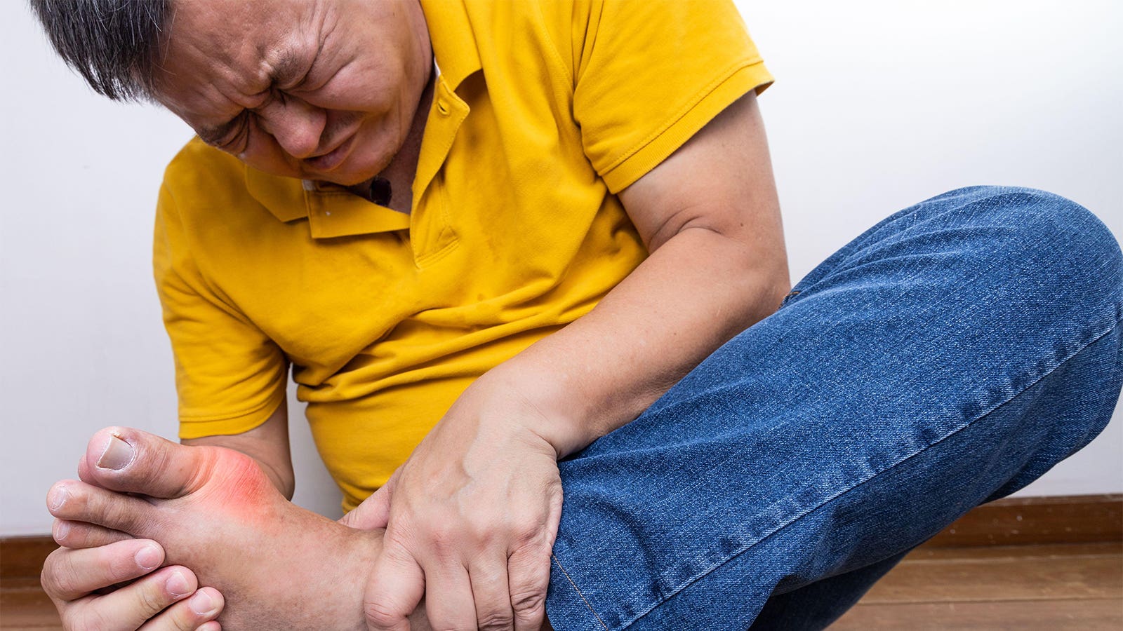 Real-world data show gout treatment disparities