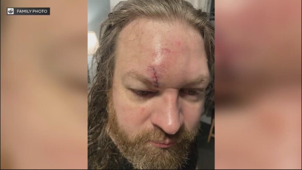 Father sucker punched over line cutting at Disneyland, family says