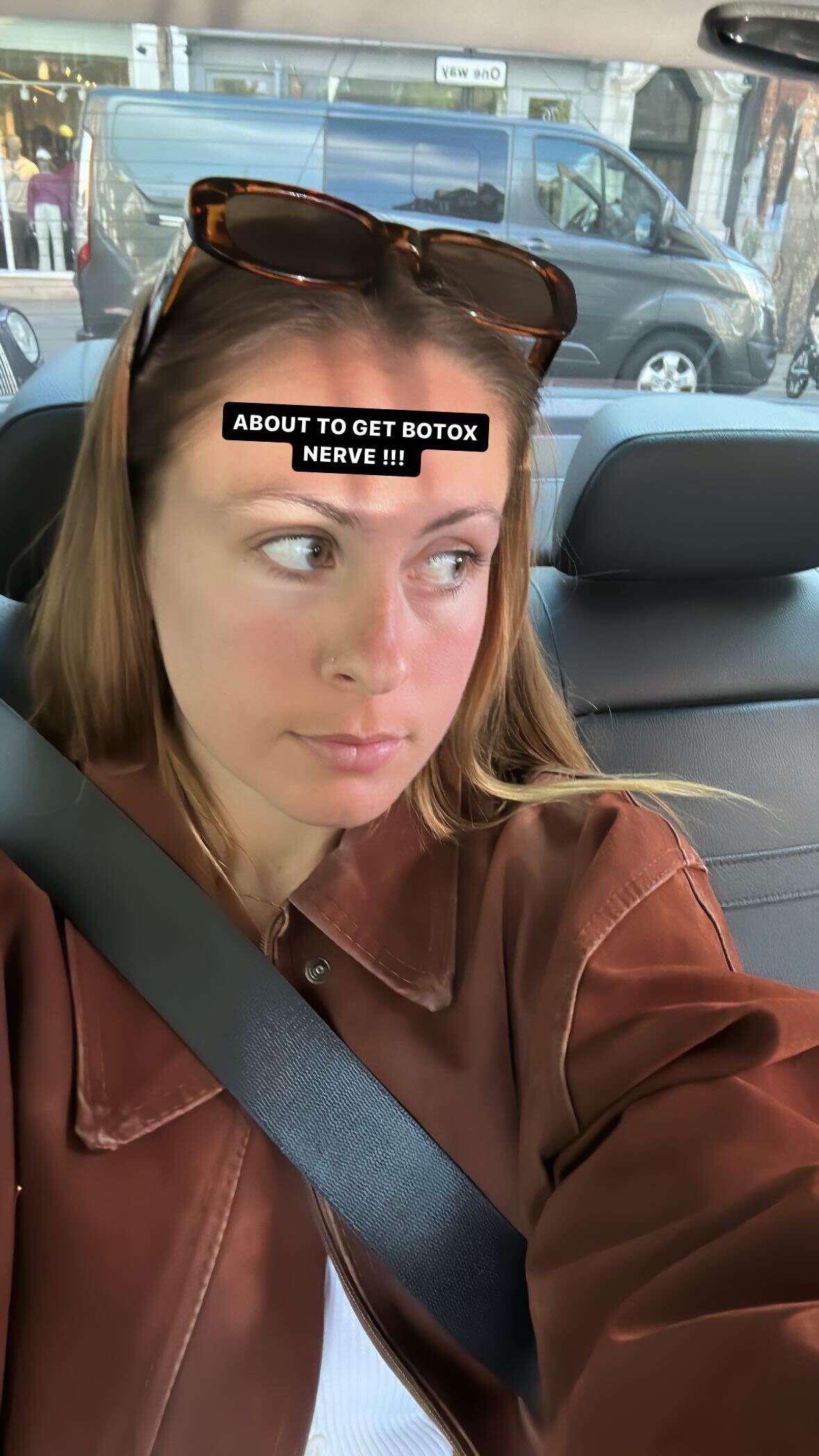 I’ve been getting Botox since I was 26 – here’s why