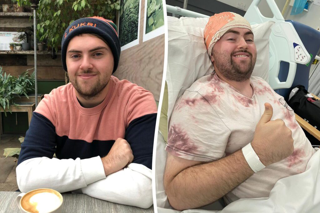 Man’s ‘running injury’ turned out to be sign of brain cancer