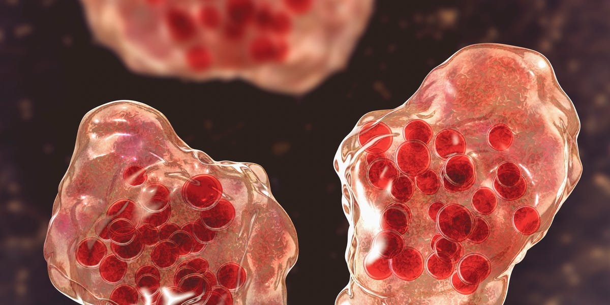 Doctors warn of highly infectious disease spreading across the US