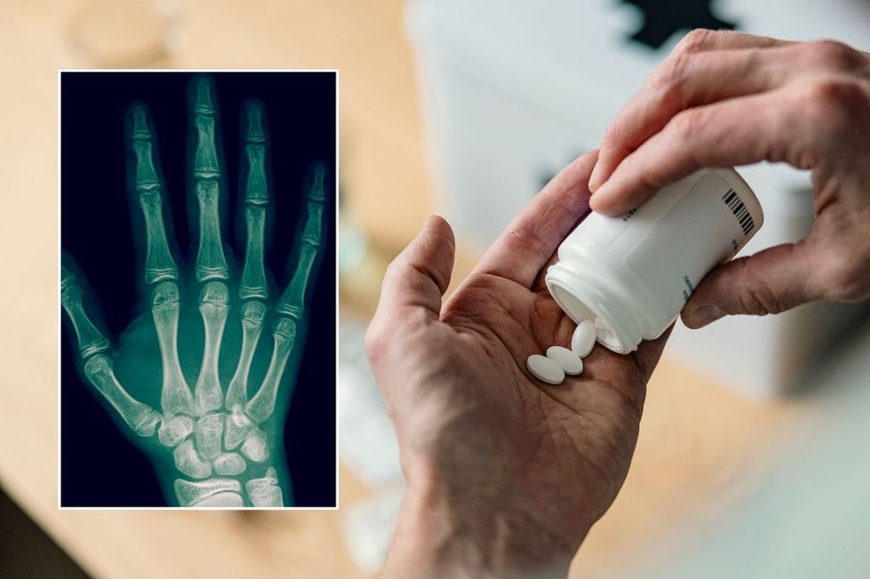 GP breaks down 'early side effects' of statins and the 'most bothersome ...