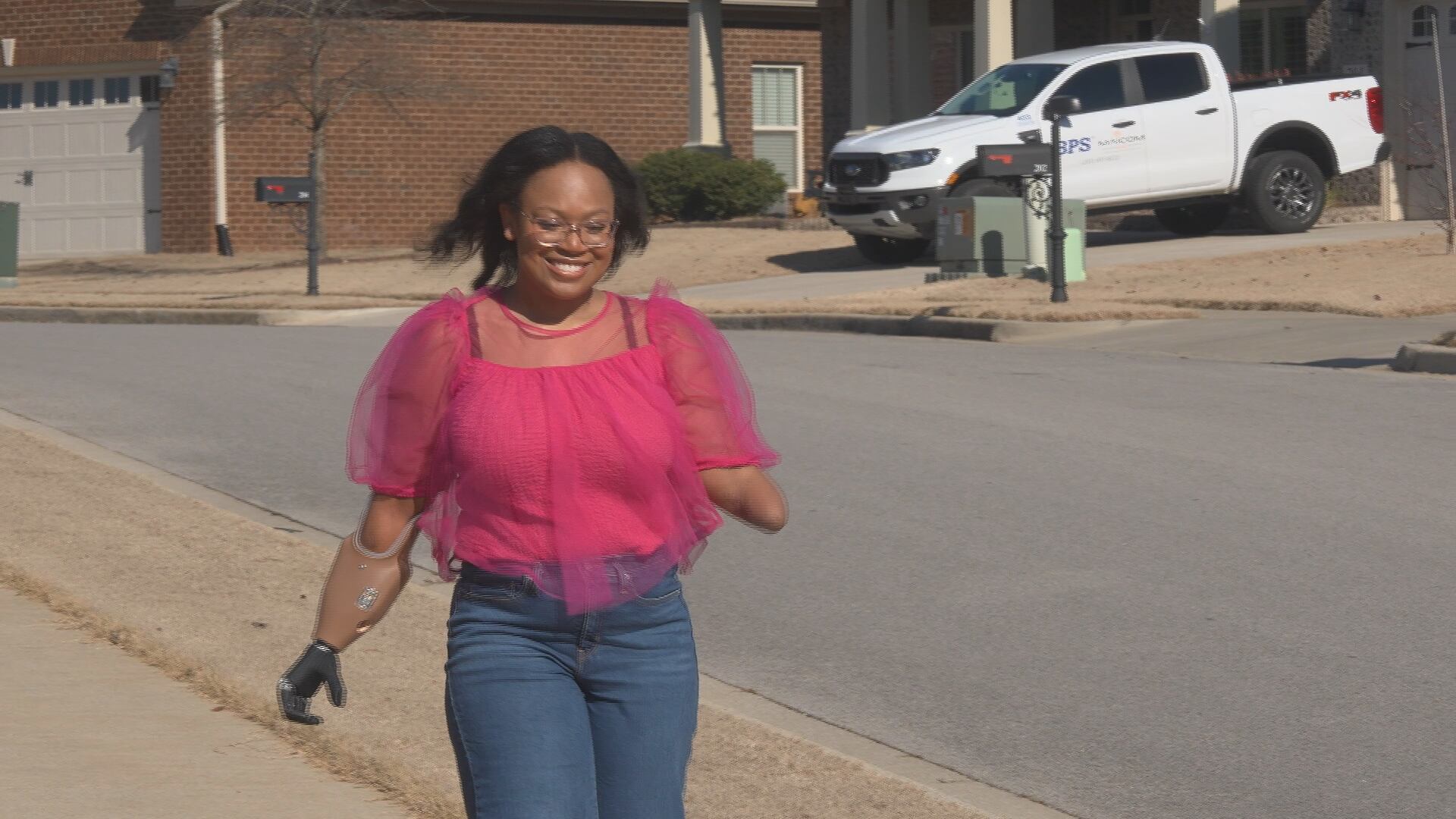 Community, Alabama senator rally around Madison woman who lost hands ...