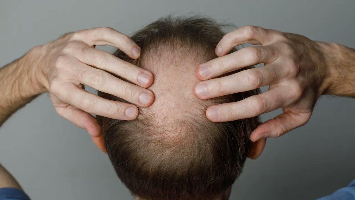 Problemas con el pelo: los dos factores que la ciencia apunta como ...