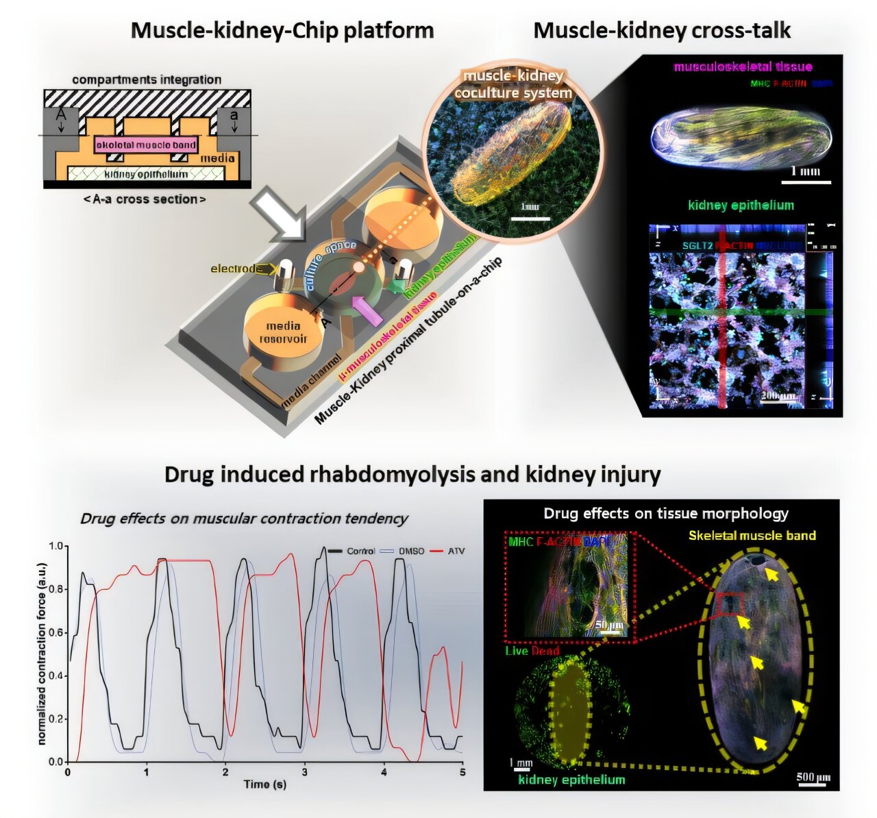 Organ-on-a-chip simulates drug-triggered muscle and kidney injury