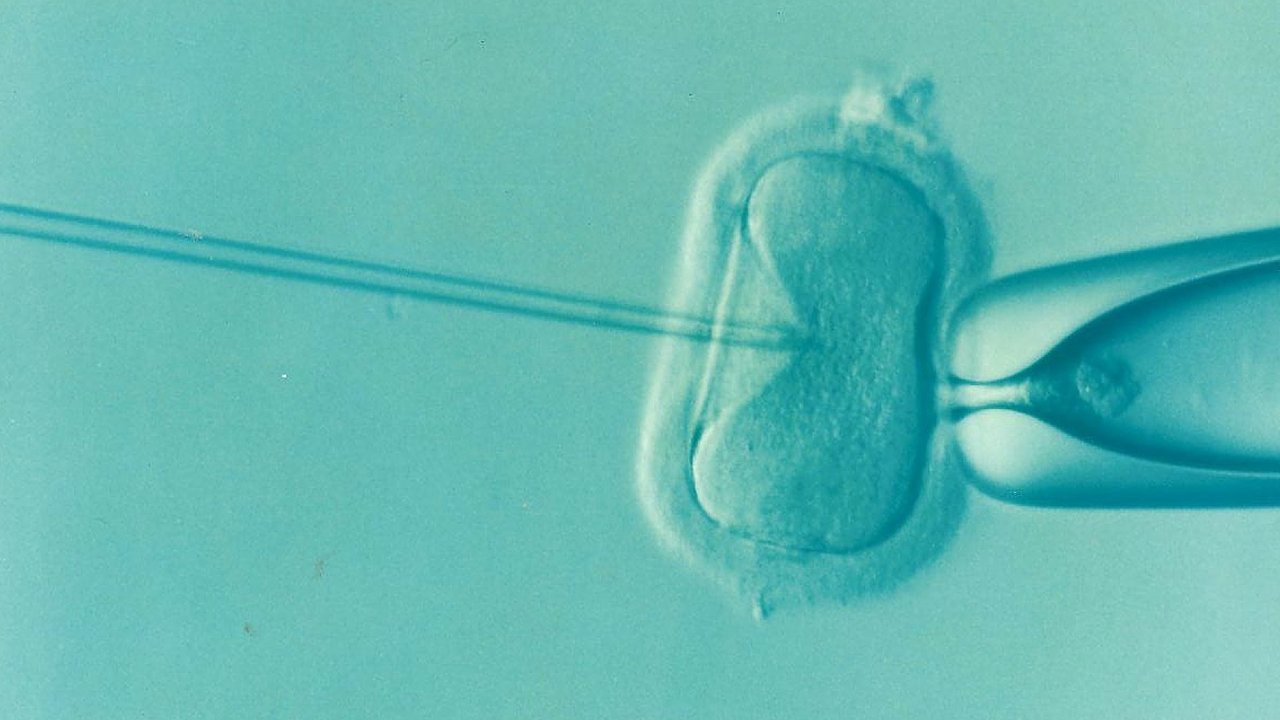 Assisted reproductive technology associated with higher risk of ...
