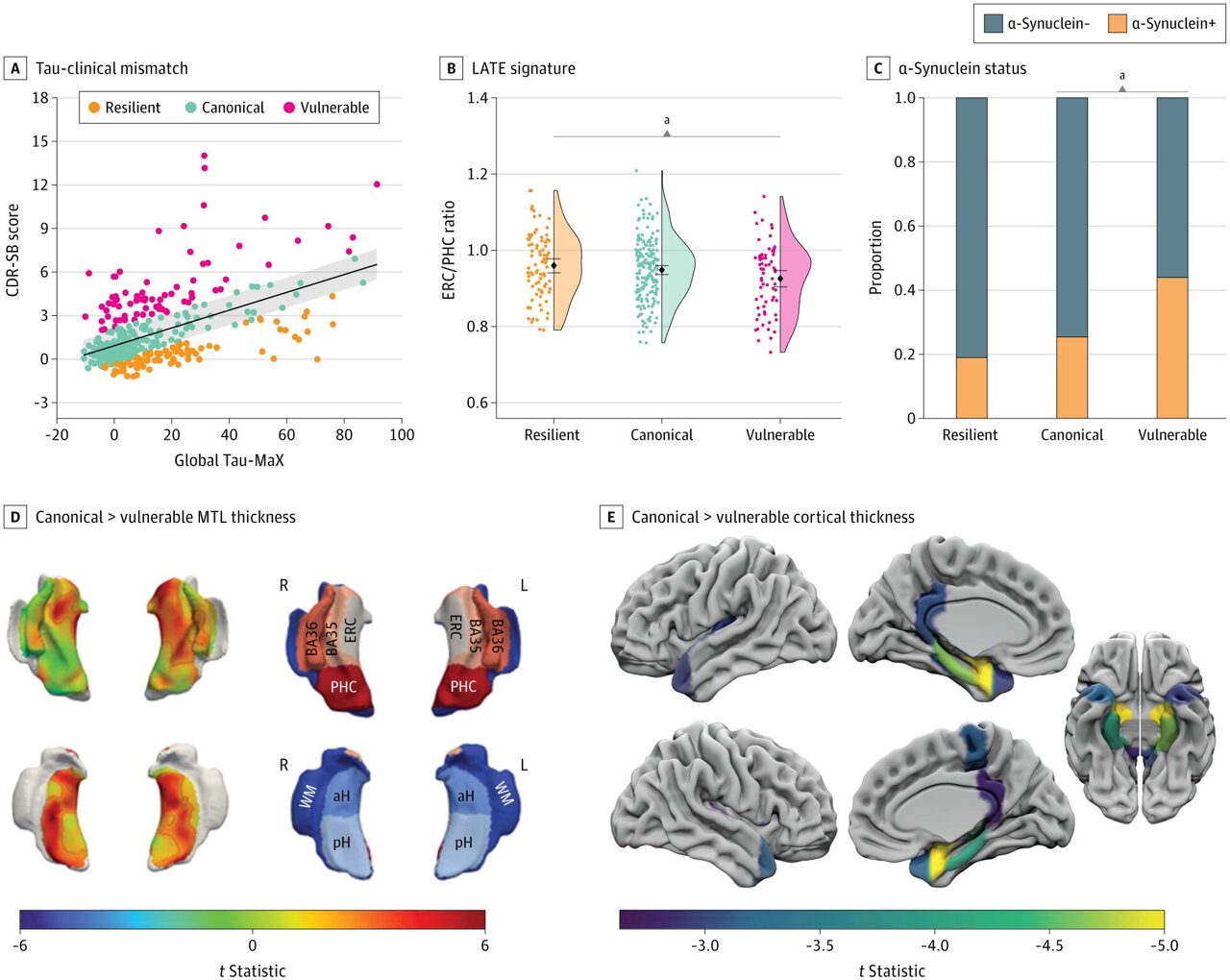 Alzheimer's symptoms often diverge from tau levels, study suggests