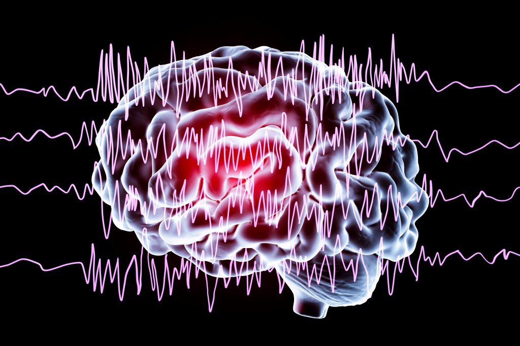 Scientists now know what happens when your mind goes blank