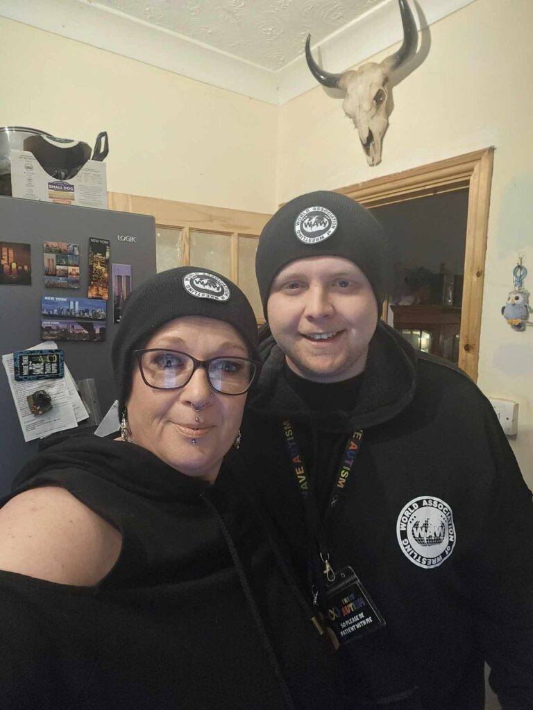 Britain’s youngest dementia sufferer, 24, dies with brain of 70-year-old