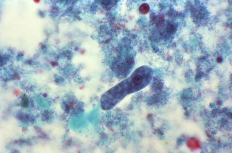 Amoebae: The microscopic health threat lurking in our water supplies ...