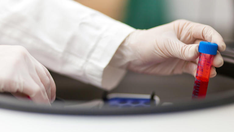 Takeda and Protagonist seek FDA approval for rusfertide to treat PV