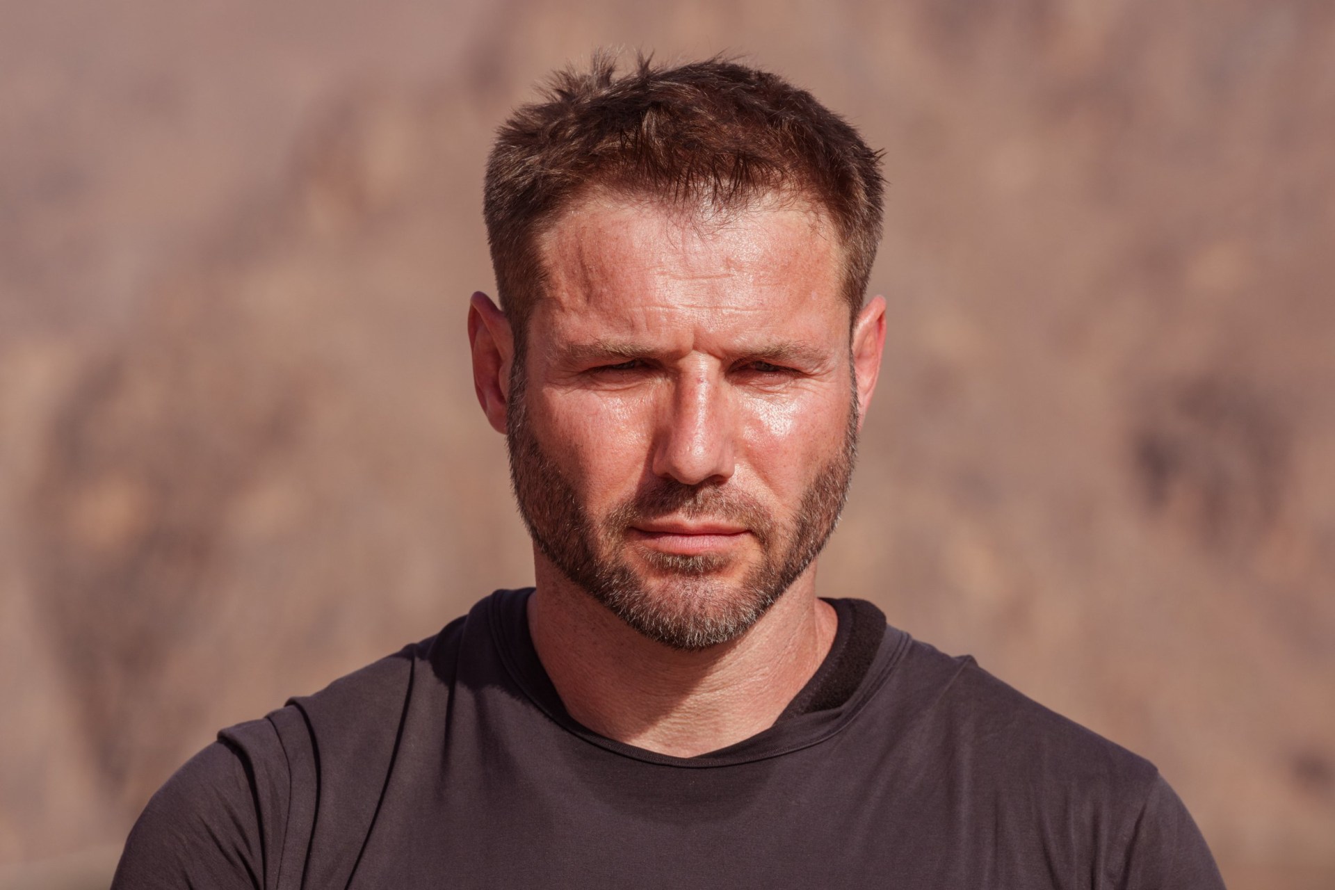 Celeb SAS star's daughter has pacemaker fitted aged 17