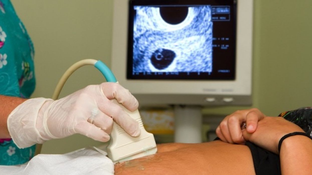 GOP trap backfires as red state's highest court kills abortion bans