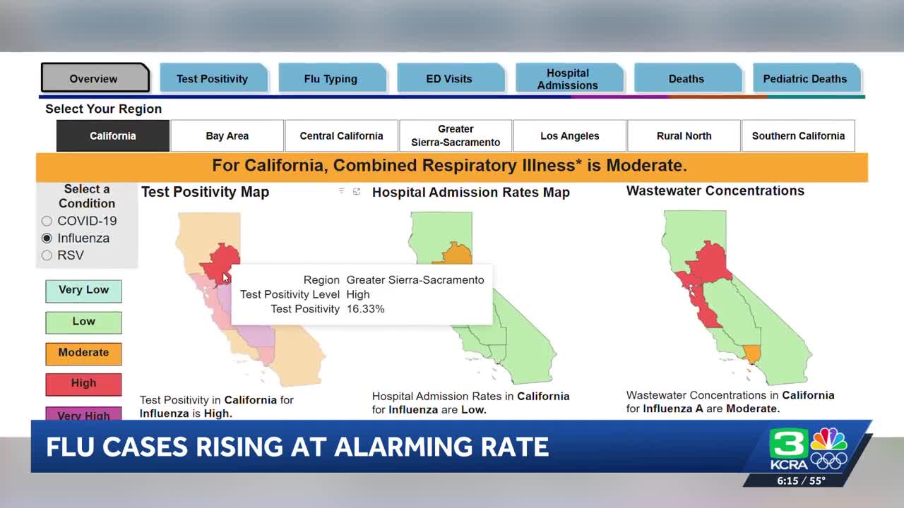 California flu levels rising at alarming rate, experts say