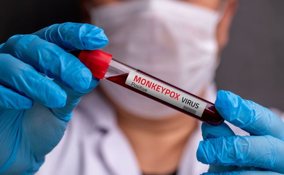 First infection of Clade 1b strain of monkeypox identified in Israel ...