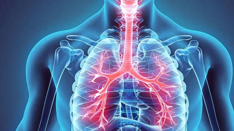 Understanding bronchial asthma and its winter triggers after Sonia ...