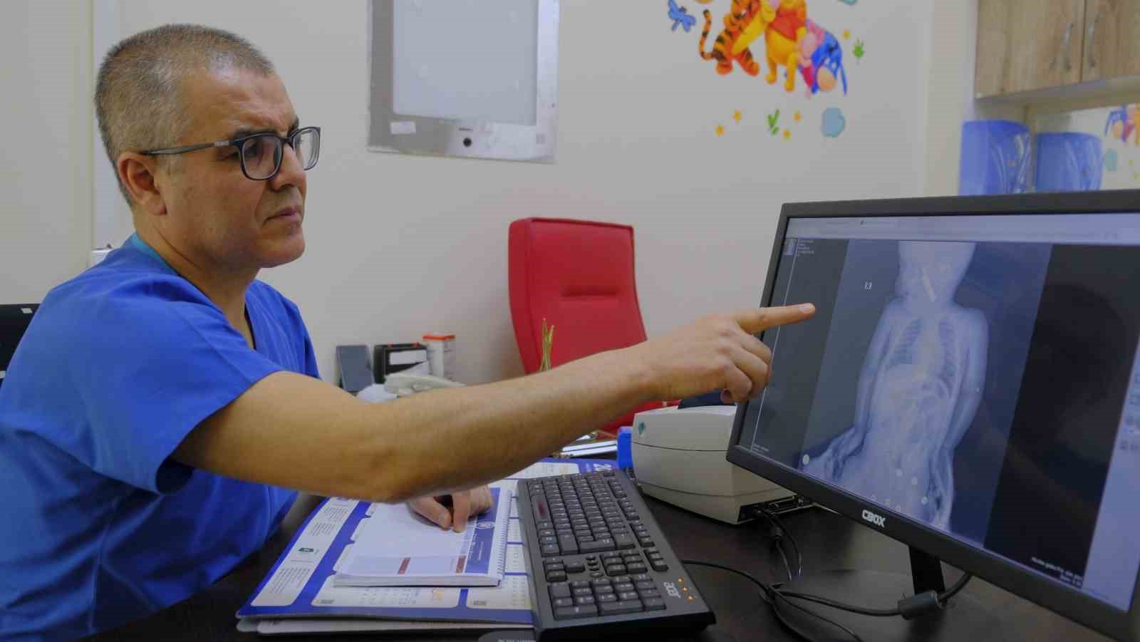 Karaman’da boğazına kumanda pili kaçan bebek ölümden döndü