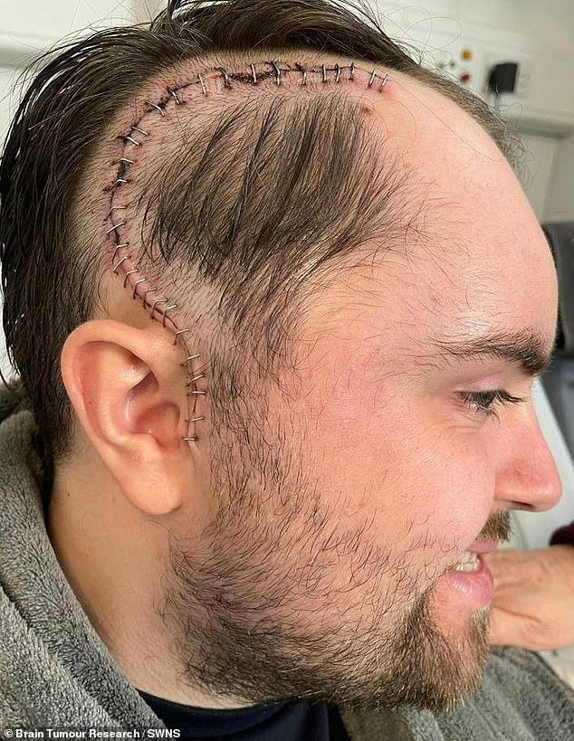 Man, 31, almost dies after 'running injury' turns out to be a sign of ...