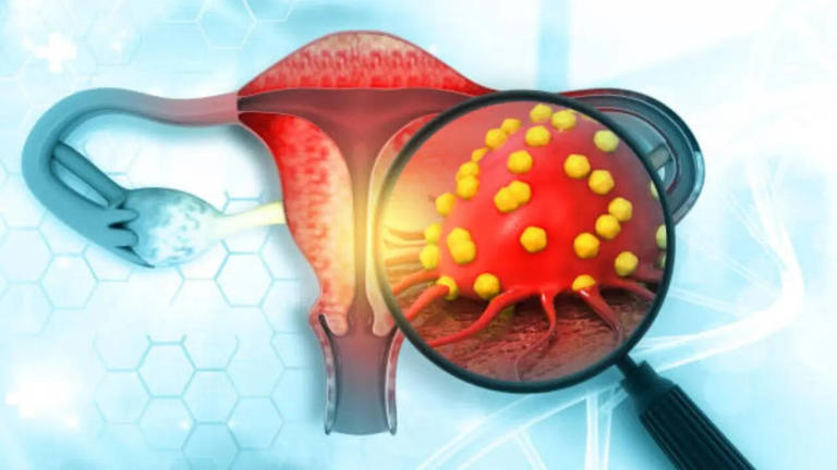 Should you get a full-body MRI? Doctors warn benefits may not outweigh ...