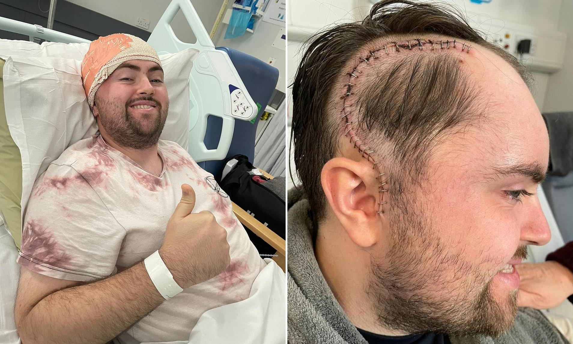 Man, 31, almost dies after running injury turns out to be a sign of ...