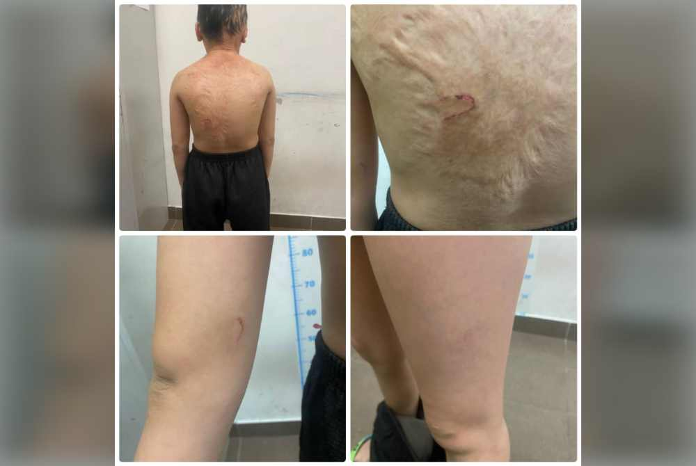 Starving 10-year-old boy found trembling outside convenience store ...