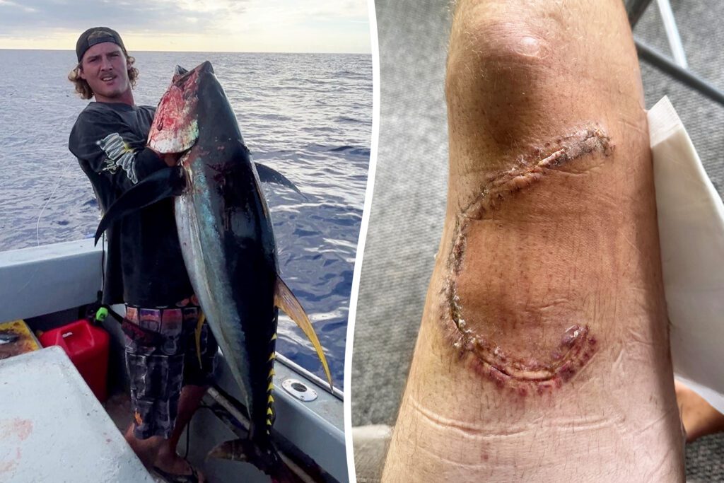 Spearfisherman survived shark attack by making tourniquet from shredded ...