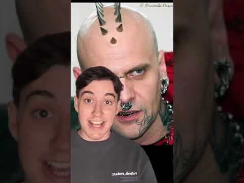 The most extreme body modifications documented in humans