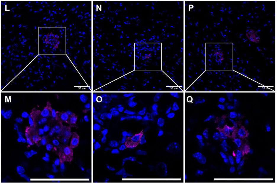 Common brain parasite can infect your immune cells—here's why that's ...