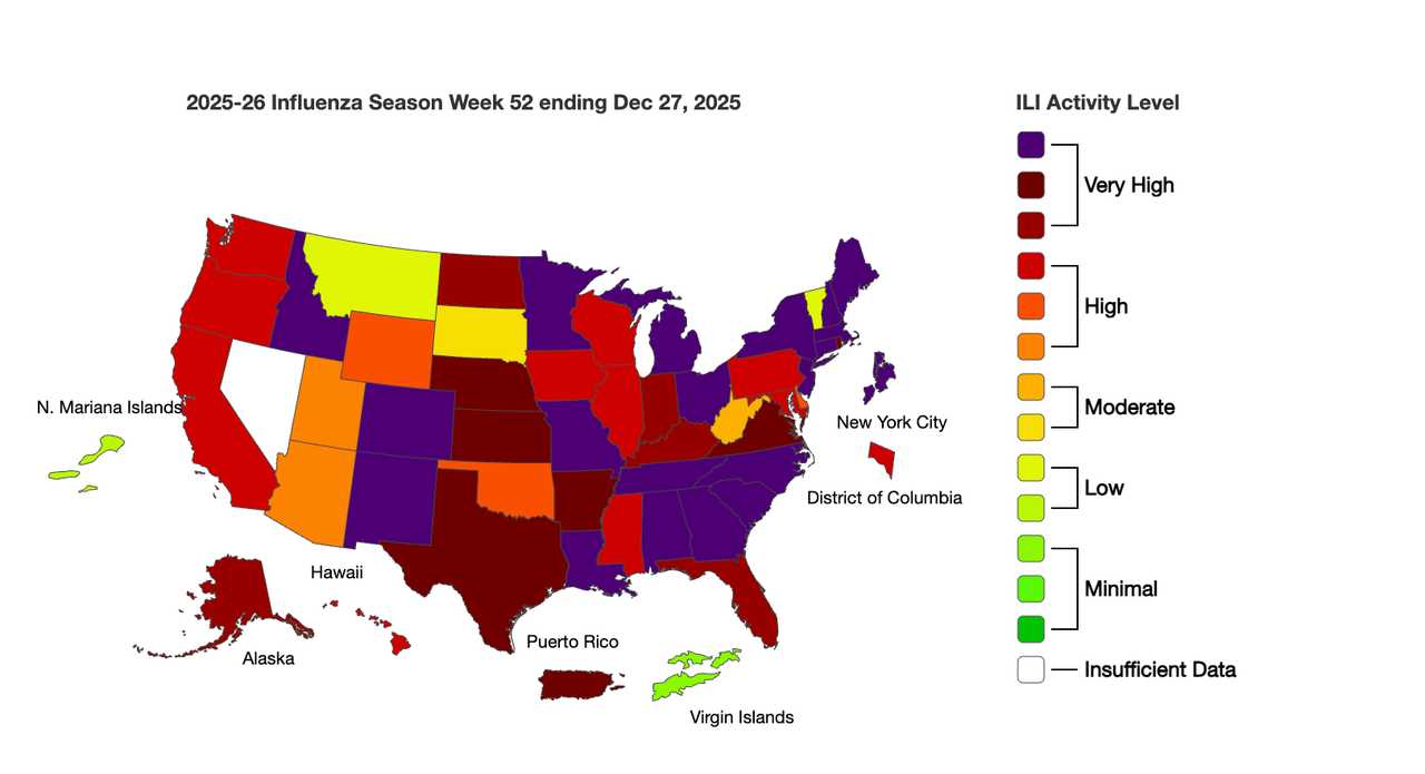 Super flu winter: CDC’s latest map lights up with widespread very high ...