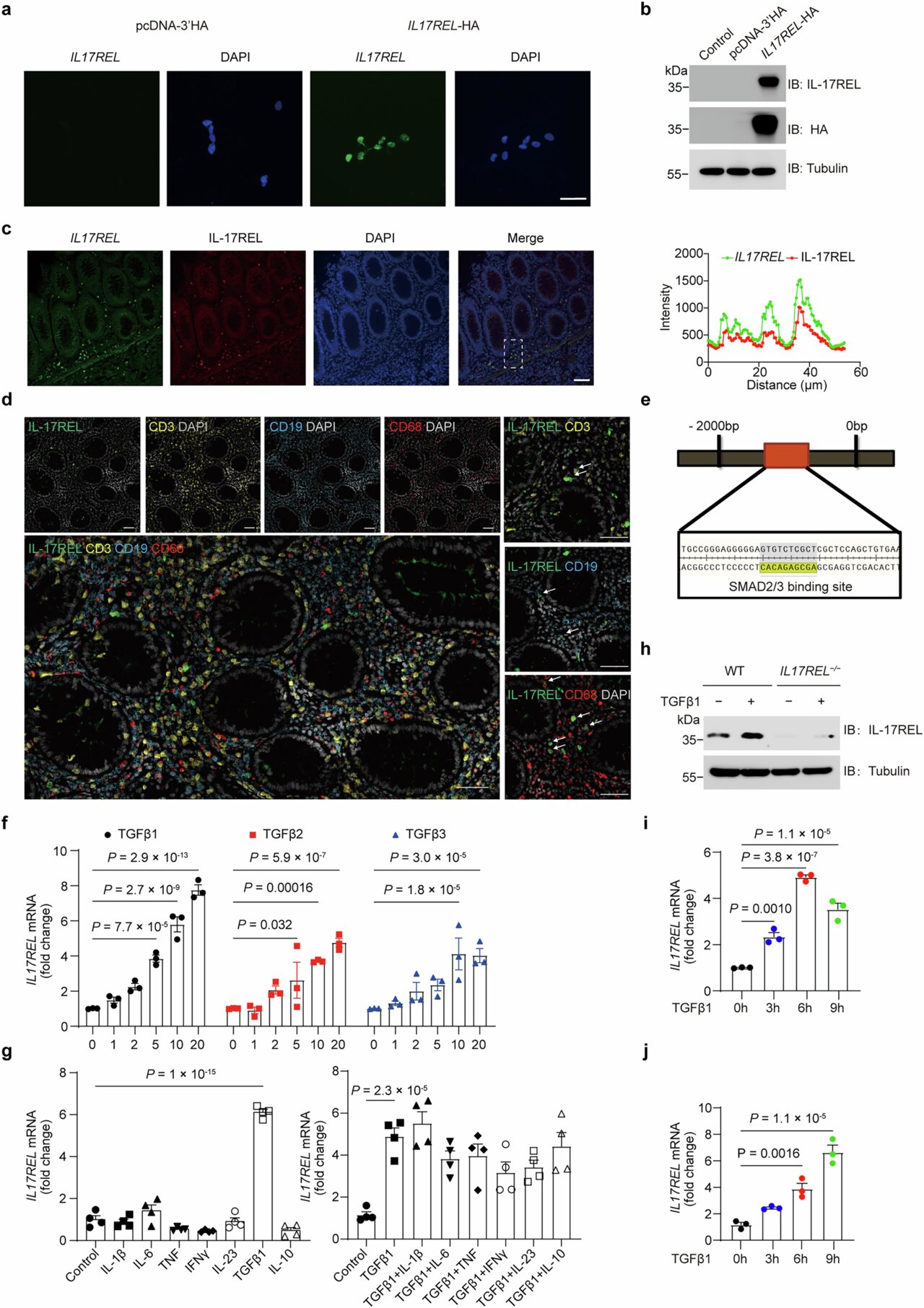 Natural 'decoy receptor' protects against inflammatory bowel disease ...