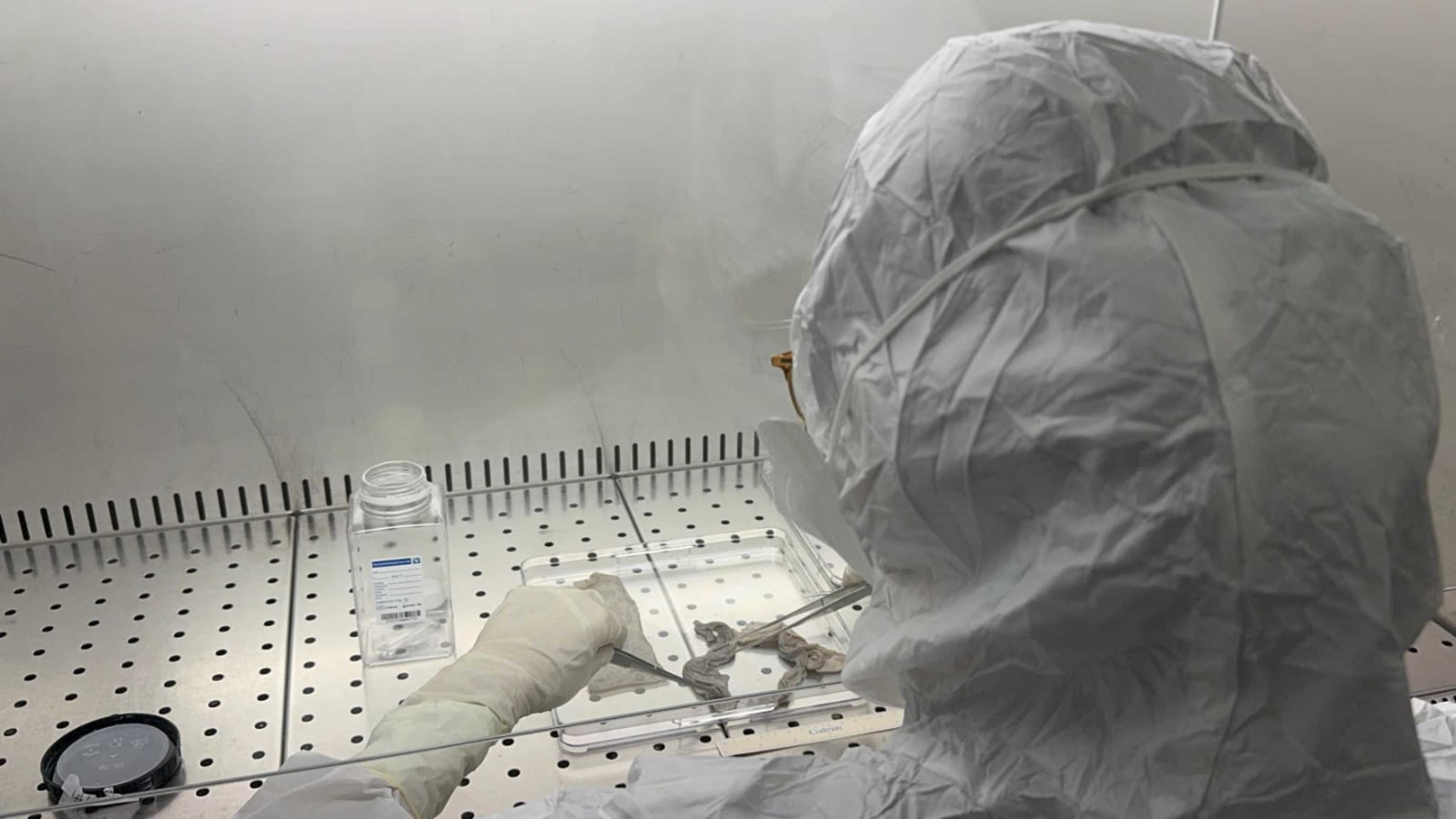 ANSA-BOX/Per 4 pazienti del Niguarda usati 13mila centimetri quadrati ...