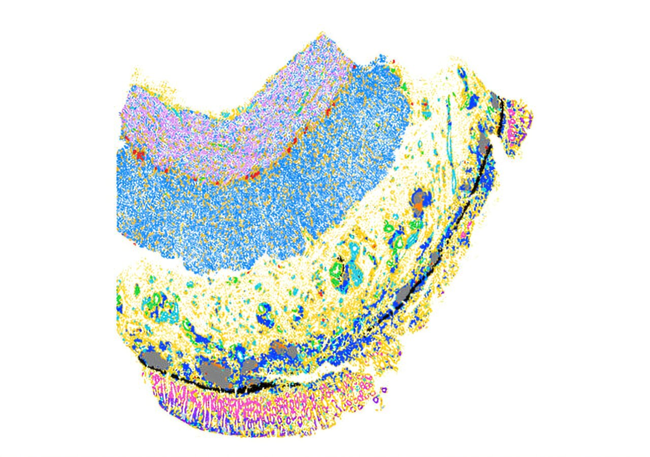 Researchers uncover molecular roots of tissue scarring in inflammatory ...
