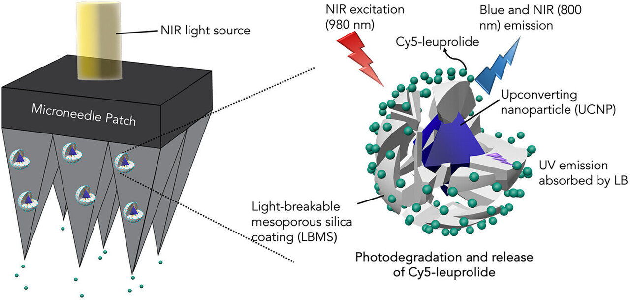 Light-triggered microneedle patch could make IVF hormone delivery ...