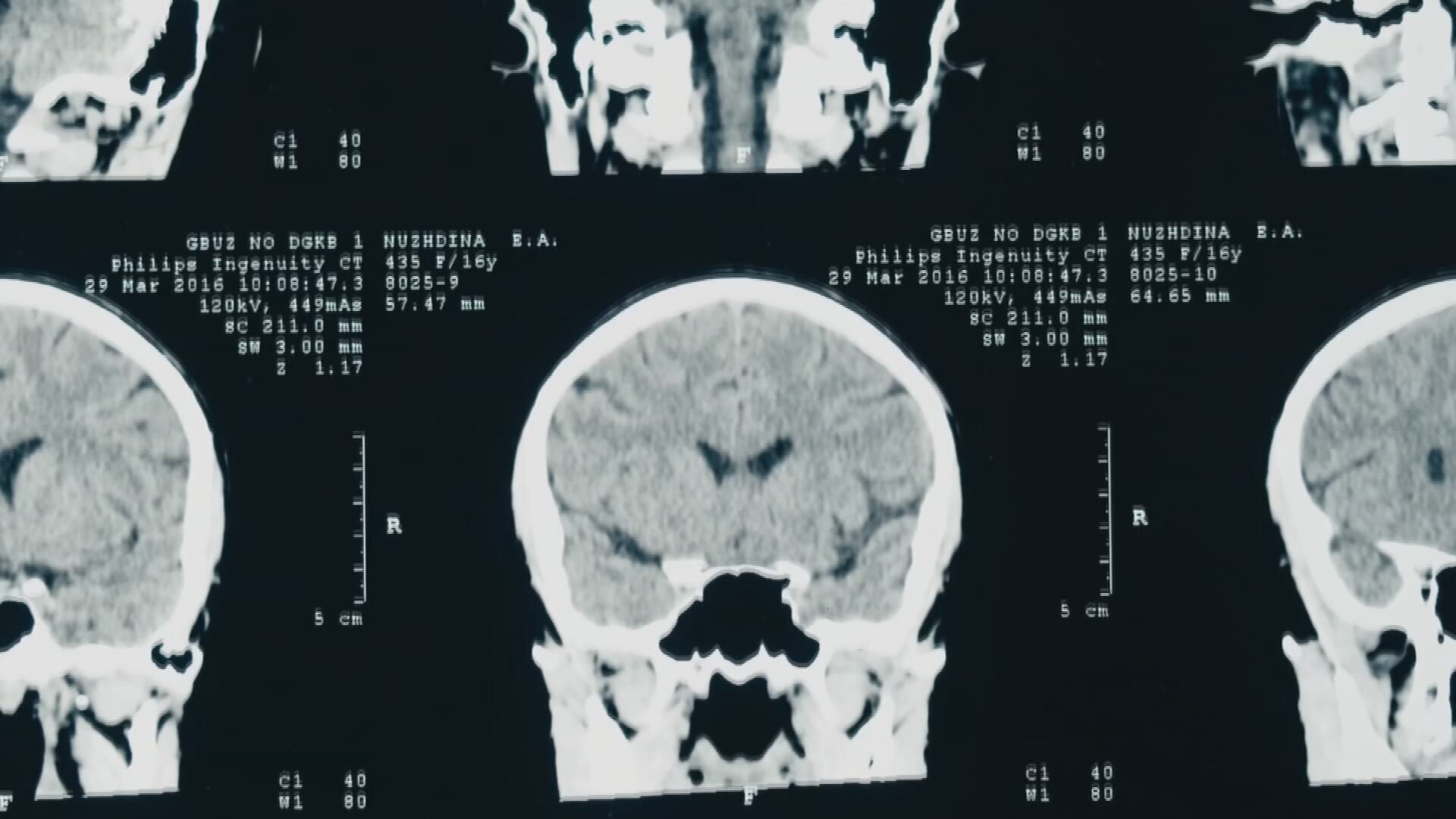 Life-changing concussion care at UPMC draws patients from around the world