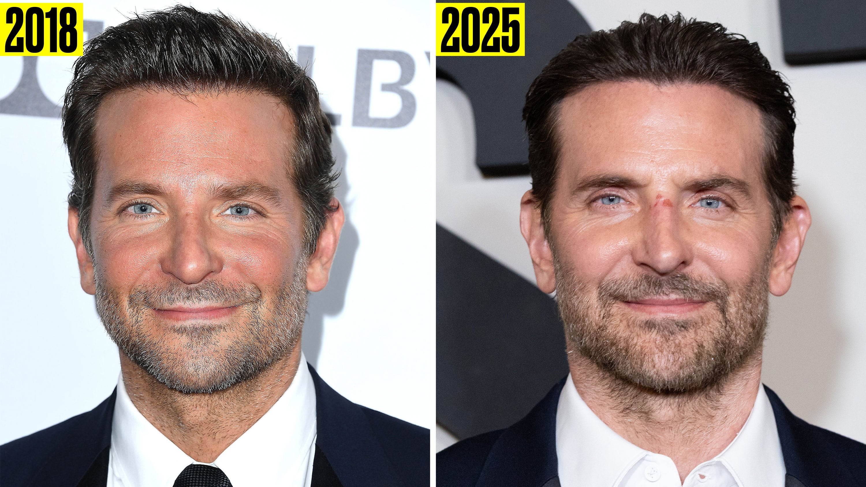Bradley Cooper, 51, addresses plastic surgery rumors