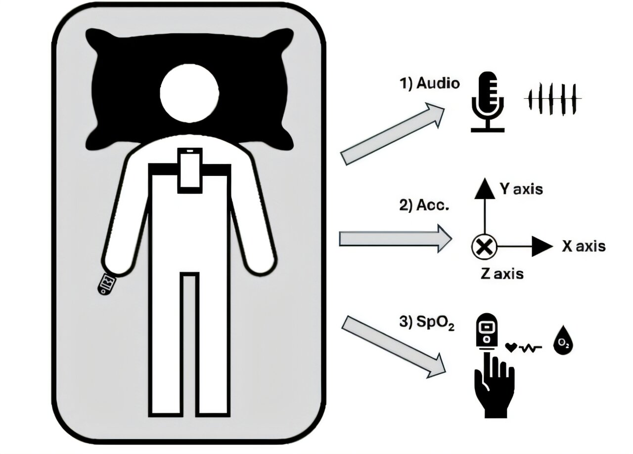 Mobile technology improves sleep apnea diagnosis after a stroke