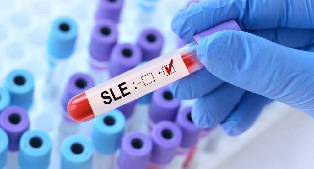 J&J’s Imaavy posts win in Phase II SLE trial