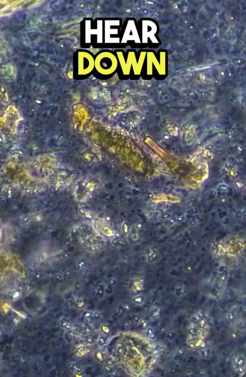 What is a shrimp “vein”? | The science explained under a microscope