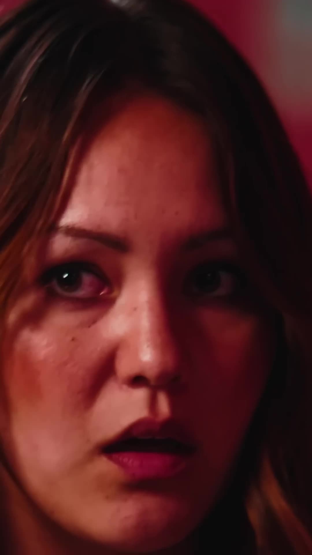 Teased for going bald?