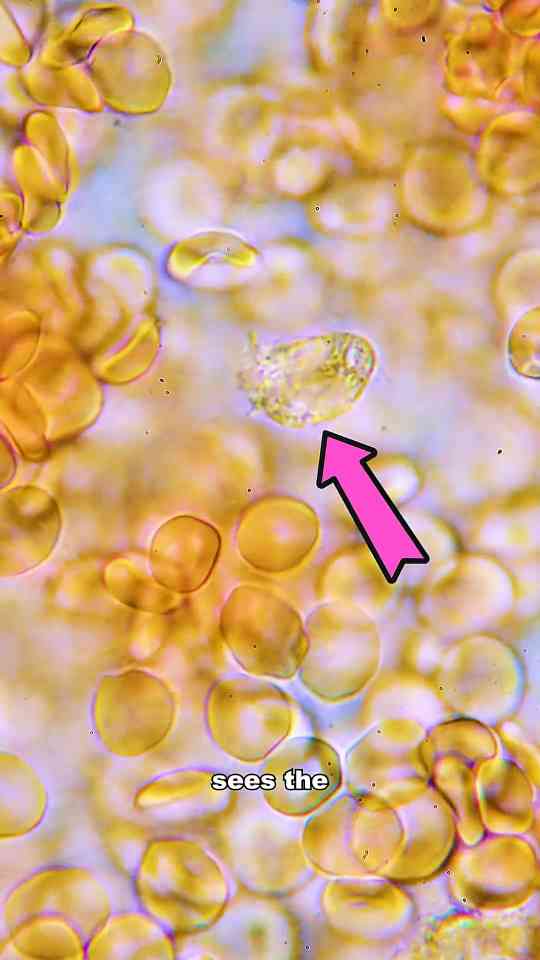 You should never mix different blood types!