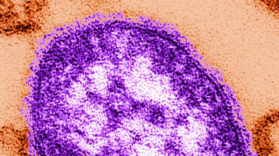 South Carolina measles cases jump 68% in one week amid holiday ...